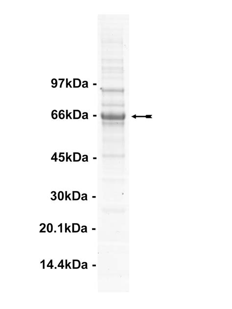Alk1 Active Kinase Soluble Proteins Eurofins Calixar
