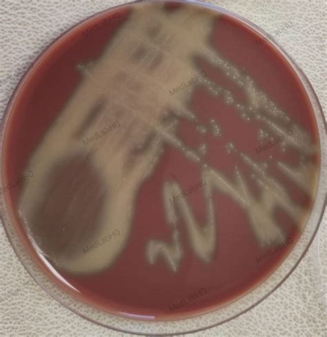Streptococcus Mitis Oralis Medlabhq