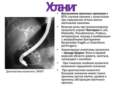 Лучевая диагностика печени поджелудочной железы желчного пузыря презентация онлайн