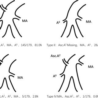 The RPA Branching Patterns Of Interlobar Portion RPA Right Pulmonary Download Scientific