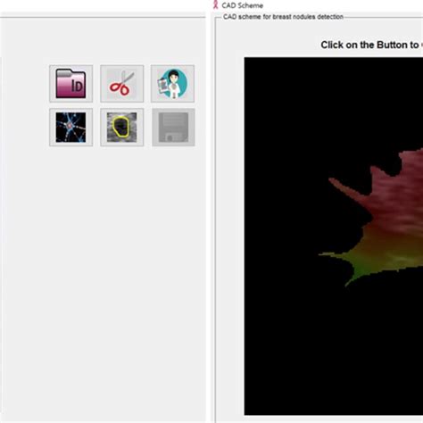 The Right Image Shows The Manual Segmentation Of The Margin Of The