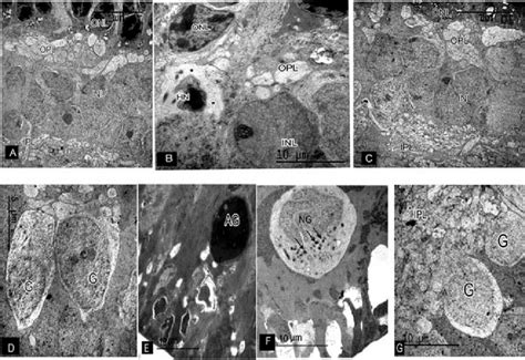 Electron Micrographs Of Inner Nuclear Layer Inl A C And