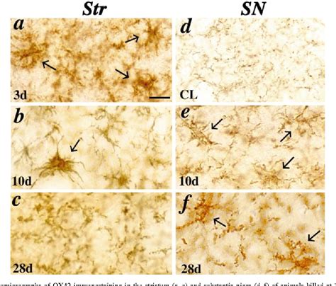 Figure 3 From Neuroin ̄ammation Of The Nigrostriatal Pathway During Progressive 6 Ohda Dopamine