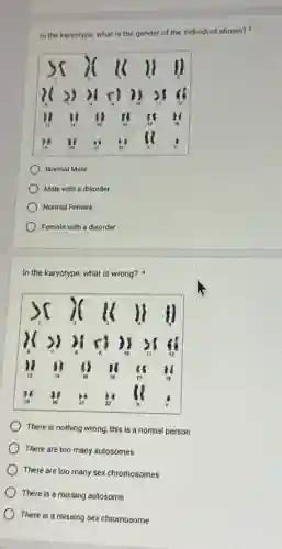 In The Karyotype What Is The Gender Of The Individual Shown Normal