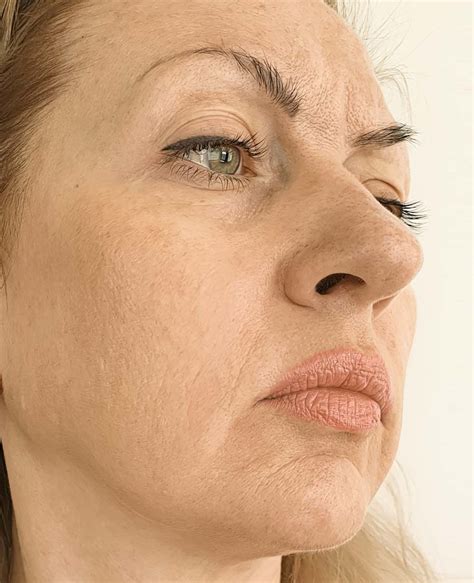 Wrinkly Skin Face