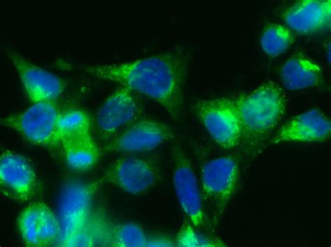 Human Serum Albumin Recombinant Monoclonal Antibody 101 Fitc Ma5 46869