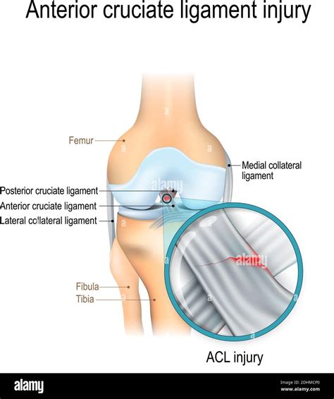 Anterior Cruciate Ligament Anatomy Stock Vector Images Alamy