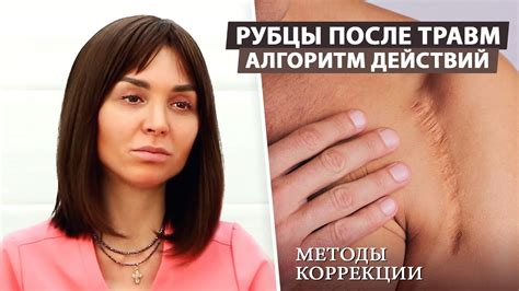 Рубцы после травм как избежать осложнений и улучшить внешний вид Youtube