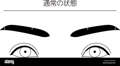 Medical Illustrations Diagrammatic Line Drawings Of Eye Diseases