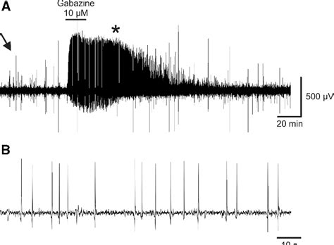 Figure 1 From Effects Of Striatal Gaba A Receptor Blockade On Striatal