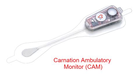 Bardy Dx Ecg Monitoring From Dot Medical Dot Medical