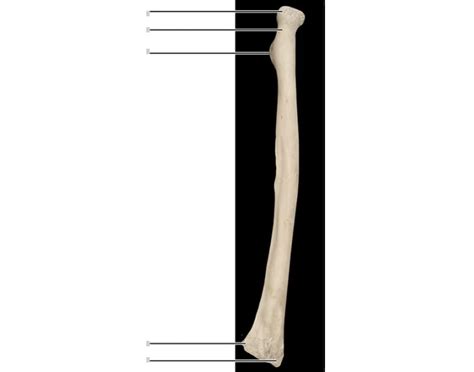 Radius Posterior Quiz