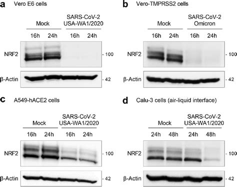 Sars Cov 2 Infection Downregulates Nrf2 Protein Levels In Epithelial