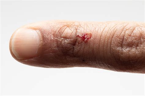 Feridas na pele e problemas de cicatrização conceito de dermocosméticos Foto Premium