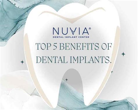 Top 5 Benefits Of Dental Implants See If They Re Right For You