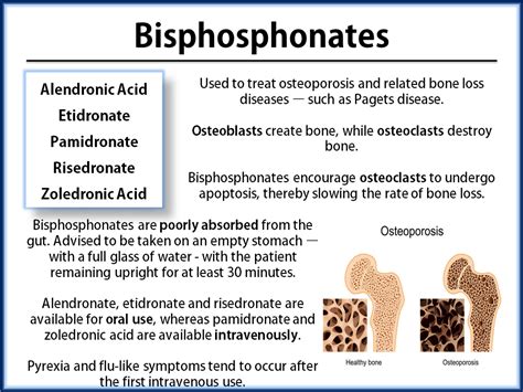 Bisphosphonates Pharmacology Pharmacology Nursing Nursing Exam