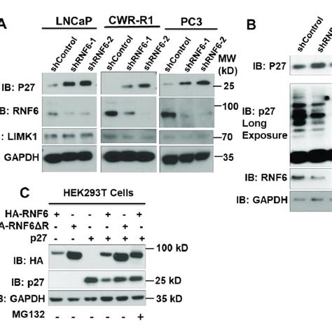 Knockdown Of Rnf6 Leads To Increase In Stability Of P27 A Prostate