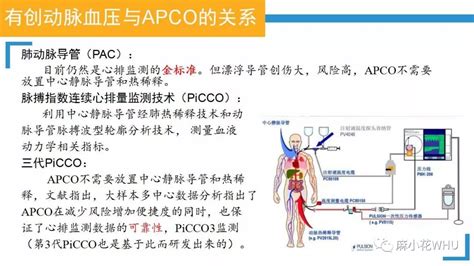 史上最详细的有创动脉血压波形解读来了！彻底明白！分析