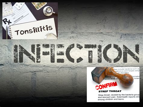 What Are Pharyngitis And Tonsillitis Trusted Medications Pharmacy © 2024