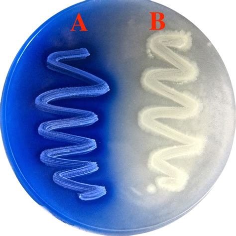 Spirit Blue Lipase Test