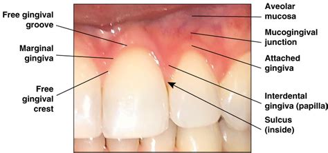 Interdental Gingiva Diagram