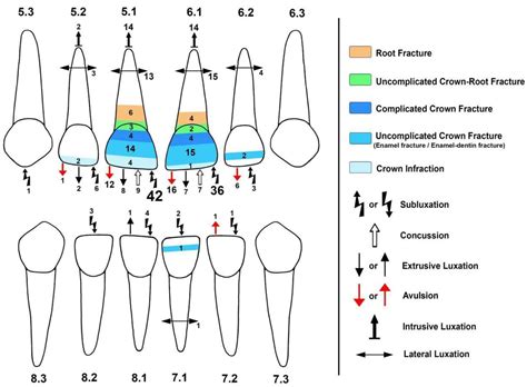 Tooth Fracture Classification