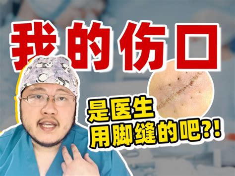 让疤痕消失的最好办法，是努力不让疤痕出现！ 整形医生肖一丁 整形医生肖一丁 哔哩哔哩视频