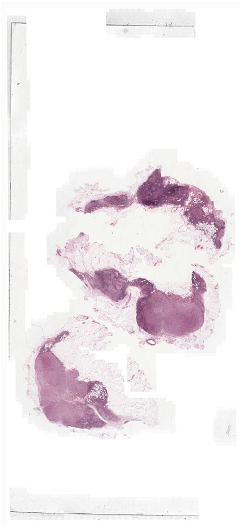 Python How To Quickly And Efficiently Check If An Image Is Mostly Background Stack Overflow