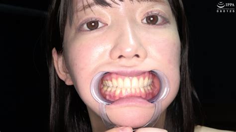 Ad 1411 【歯・口内】アイドルの激レアな舌、のどちんこ、歯観察プレイ 宇佐美みおん Javbus