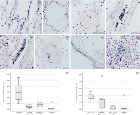 Immunostaining For Citrullinated Histone H3 Cith3 Dark Blue