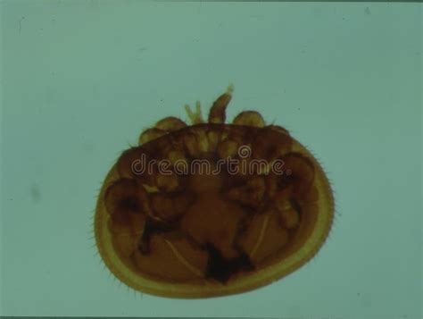 Varroa Bee Mite Stock Image Image Of Arachnids Claw 194441861