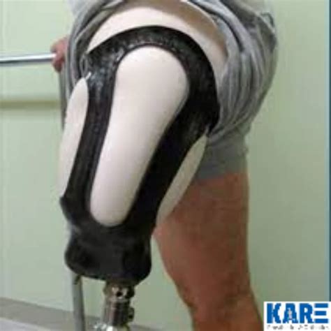Hifi Interface Socket Prostheses Full Leg At Best Price In Bengaluru Id 2852181081333