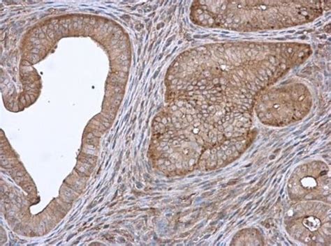 Annexin A4 Polyclonal Antibody Invitrogen 100 μL Unconjugated