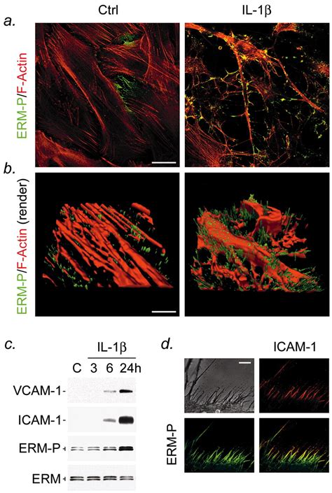 Interleukin 1β Induces A Reactive Astroglial Phenotype Via Deactivation