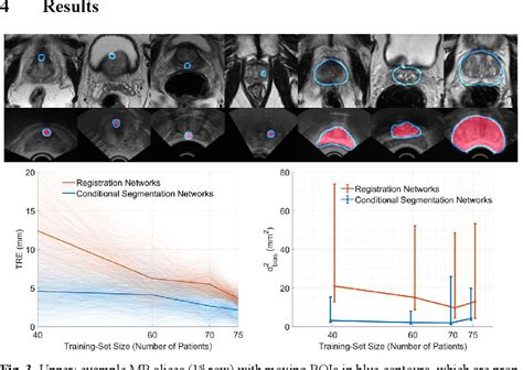 Conditional Segmentation In Lieu Of Image Registration