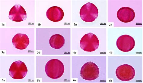 Palynological Micrographs Taken With An Optical Microscope 1