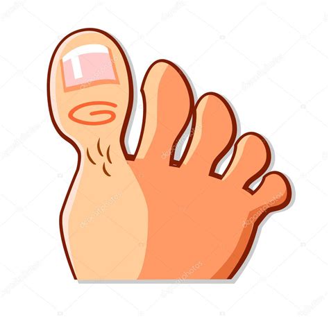 Foot And Big Toe — Stock Vector © Kk Inc 10460404