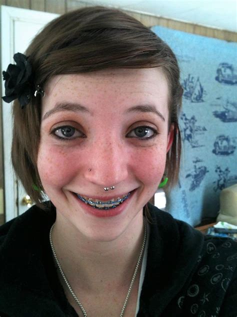 Pin By John Beeson On Girls In Braces Braces Girls Beautiful Smile