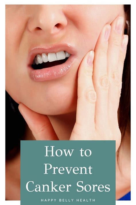 Can Canker Sores Be Prevented Artofit