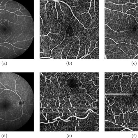 Examples Of Healthy And Pathological Eye Cases First And Second Row