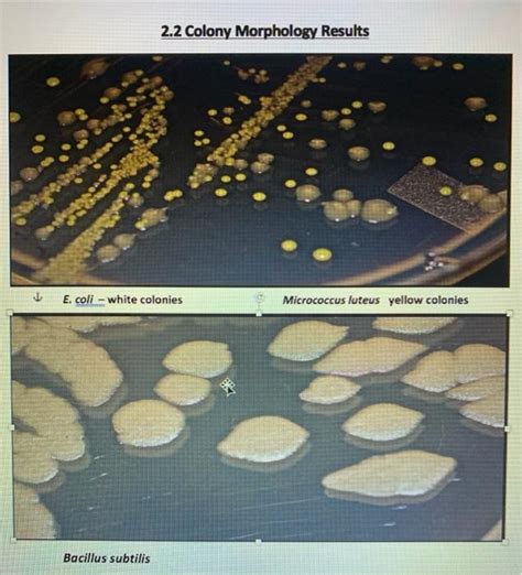Solved 2 1 Colony Morphology Observations And