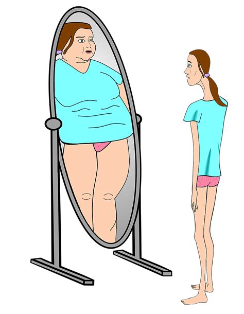 신경성 식욕부진증거식증anorexial Nervosa란 원인 진단 및 치료