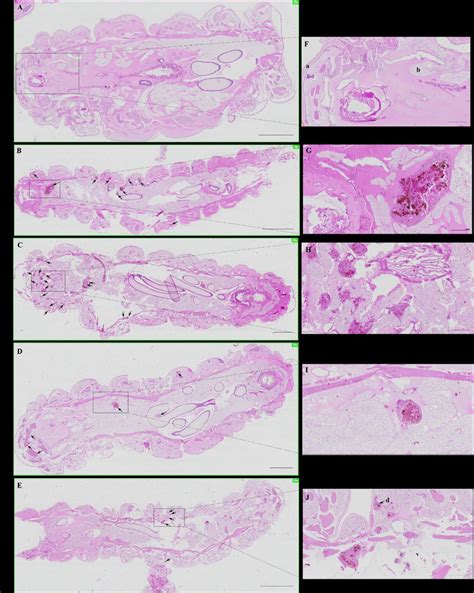 Pcn Effect On The Virulence Of P Brasiliensis According To