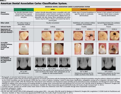 The American Dental Association Caries Classification System For Clinical Practice The Journal