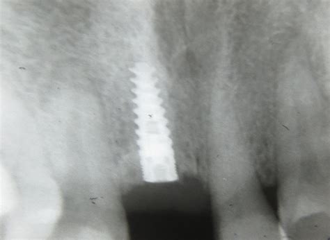 Typeset Prod Media Articleuploads