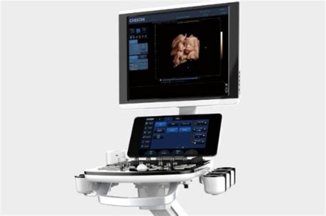 Chison Cbit 8 Ortner Medizintechnik