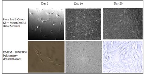 Osteogenic Differentiation Of Hmscs Download Scientific Diagram