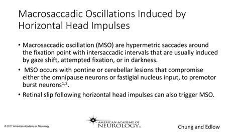 A 33 Year Old Woman With Chronic Dizziness Ppt Download