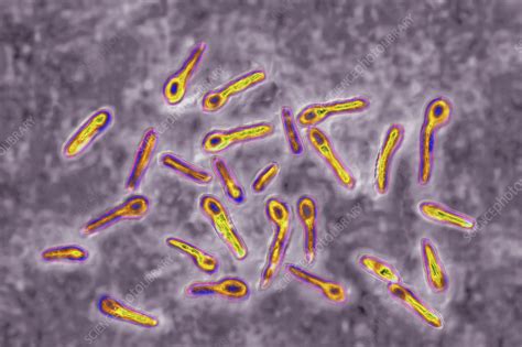 Clostridium Tetani Bacteria Light Micrograph Stock Image C0610039