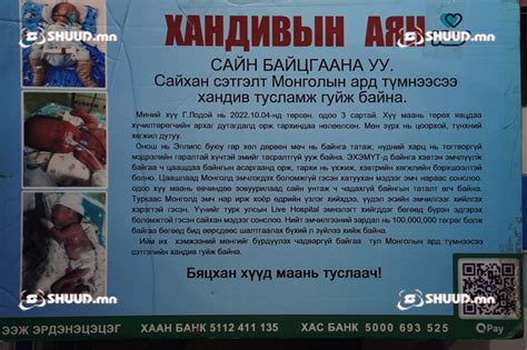 Төрөх явцыг буруу удирдсанаас болоод миний хүү УРГАМАЛ шиг болчихлоо